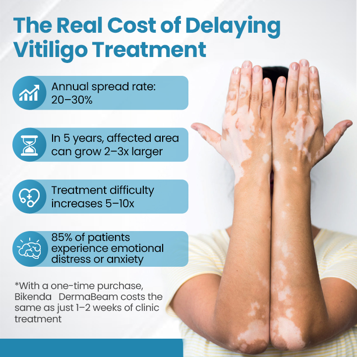 FLORENIE SHOP - 🔥10,000+ sold in last 30 days_DermaBeam Vitiligo ...